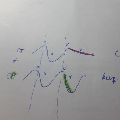 JVP: สาระความรู้